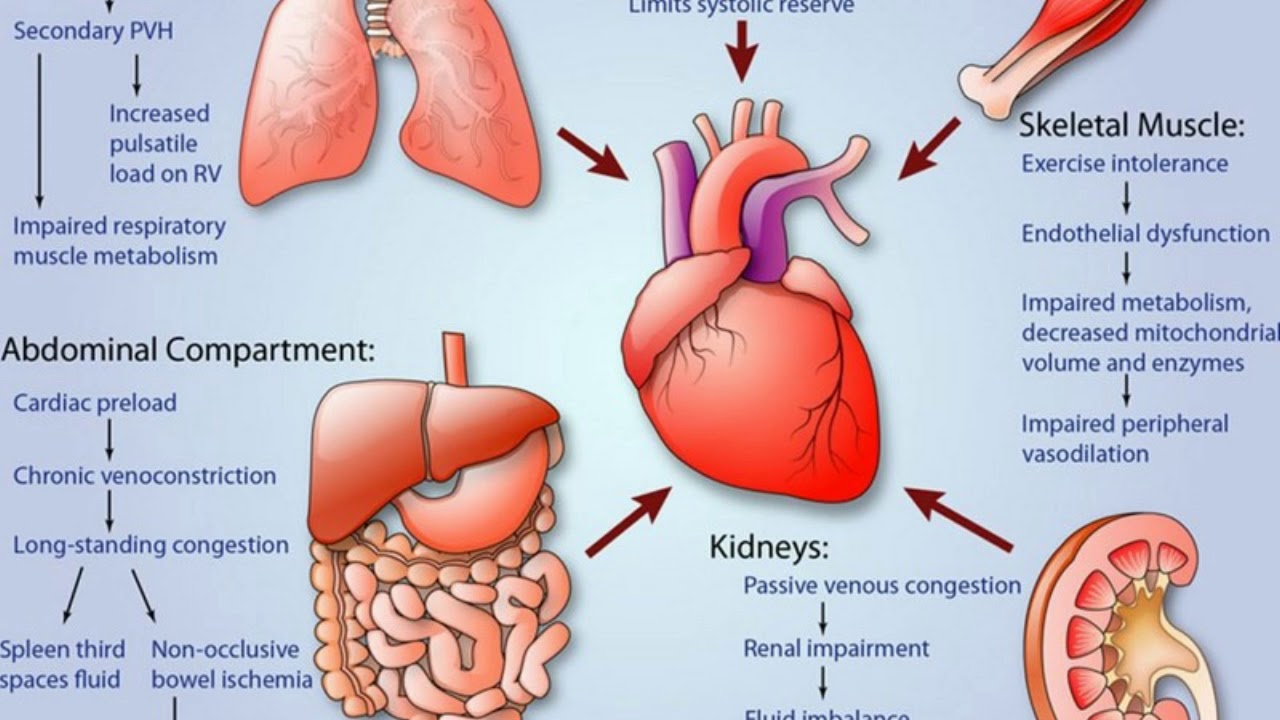 Difference Between Right Sided And Left Sided Heart Failure Youtube