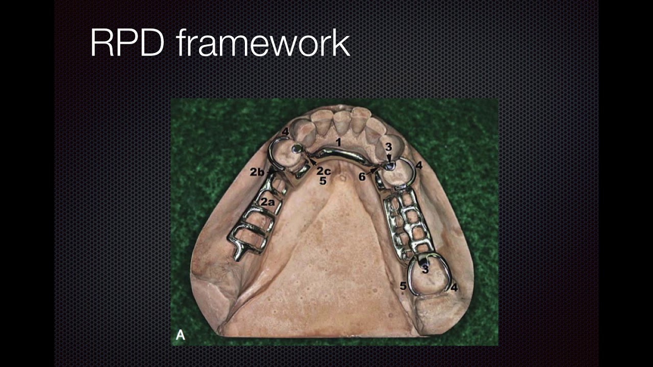 1 Introduction Of Rpd Module In Drd 8005 Components Of The Removable