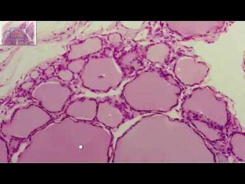 Thyroid Youtube