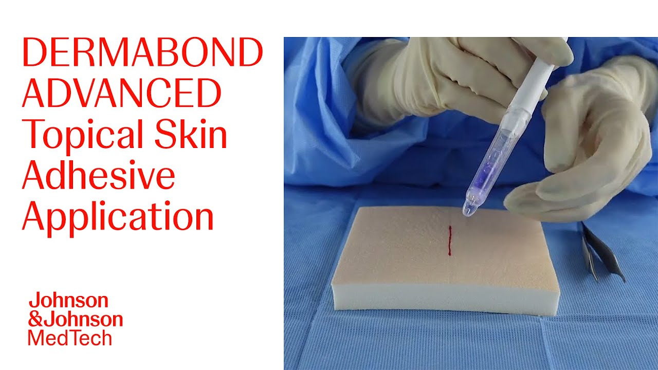How To Apply Dermabond Advanced Topical Skin Adhesive For Wound Closure