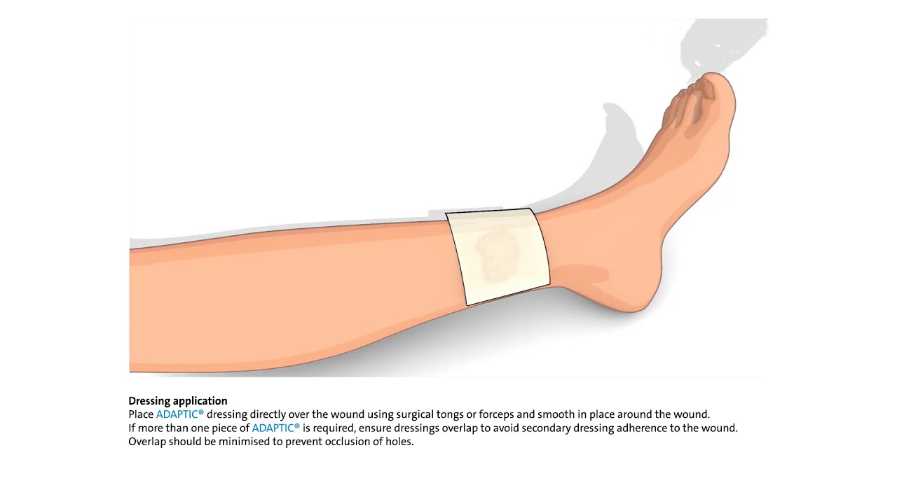 How To Use Adaptic Youtube