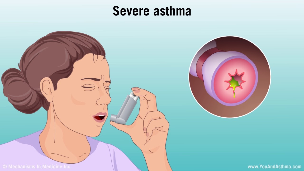 пёџ Asthma Youtube