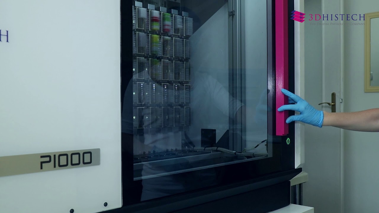 3dhistech Digital Pathology Solutions For Routine Pathology Youtube