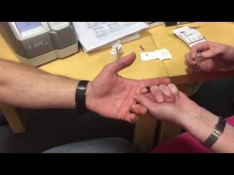 Afinion Crp Otto Youtube