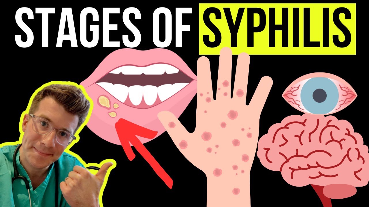 Doctor Explains The Symptoms And Stages Of Syphilis Sti Youtube