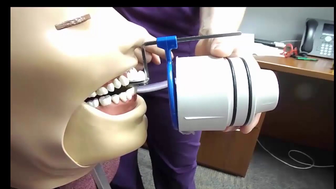 Mandibular Anterior Placement Video 7 27 16 Youtube