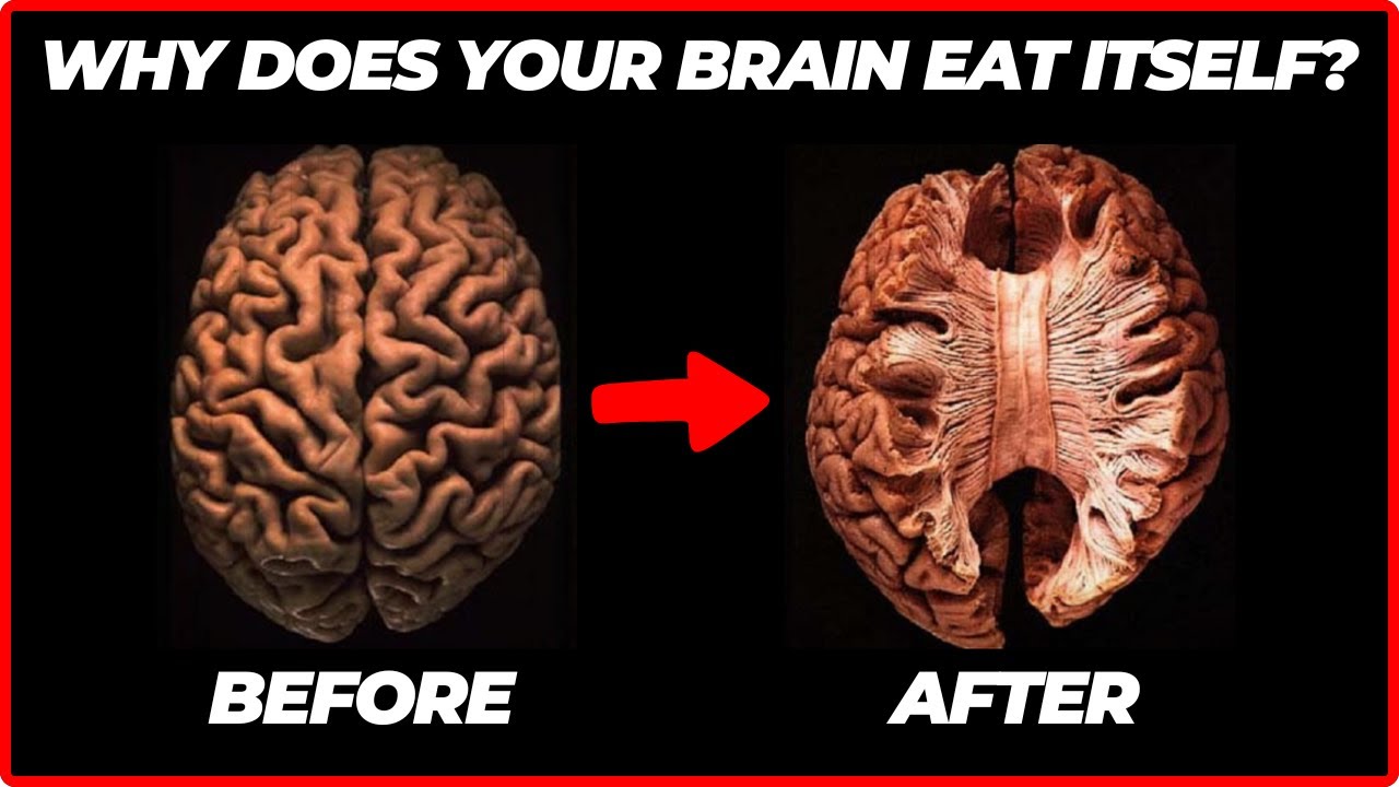 Why Does Your Brain Eat Itself Youtube
