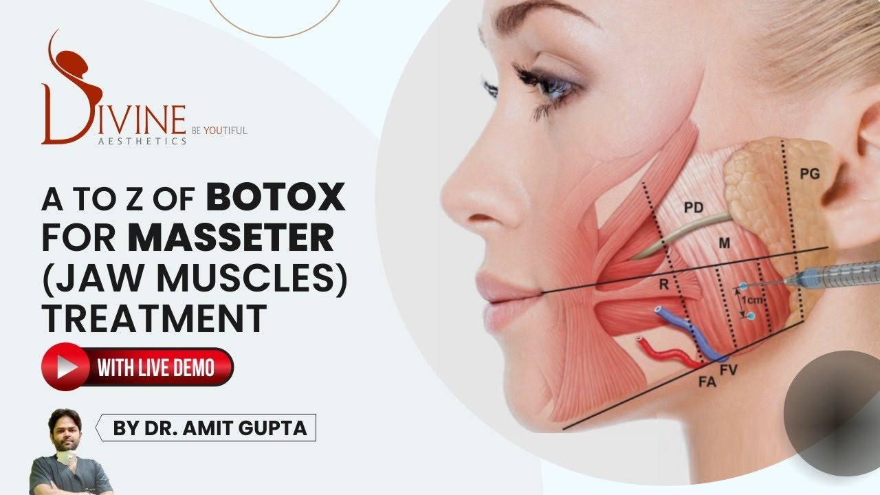 Botox For Masseter Jaw Muscles Treatment Botox Treatment For Face