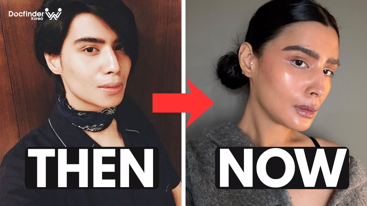 My Ffs Breast Augmentation Journey In Korea My Full Transformation