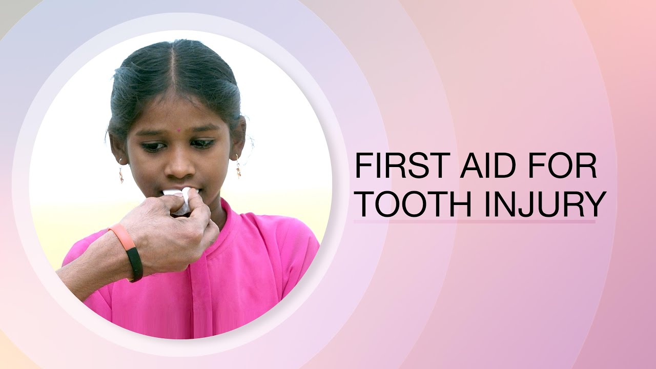 First Aid For Tooth Injury Kims Hospitals Youtube