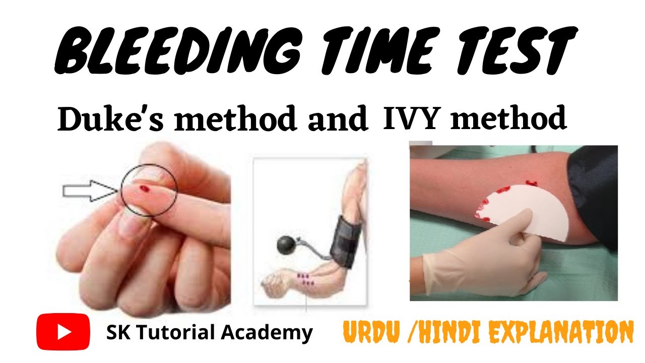 Bt Ct Test Bleeding Time And Clotting Time Coagulation 55 Off