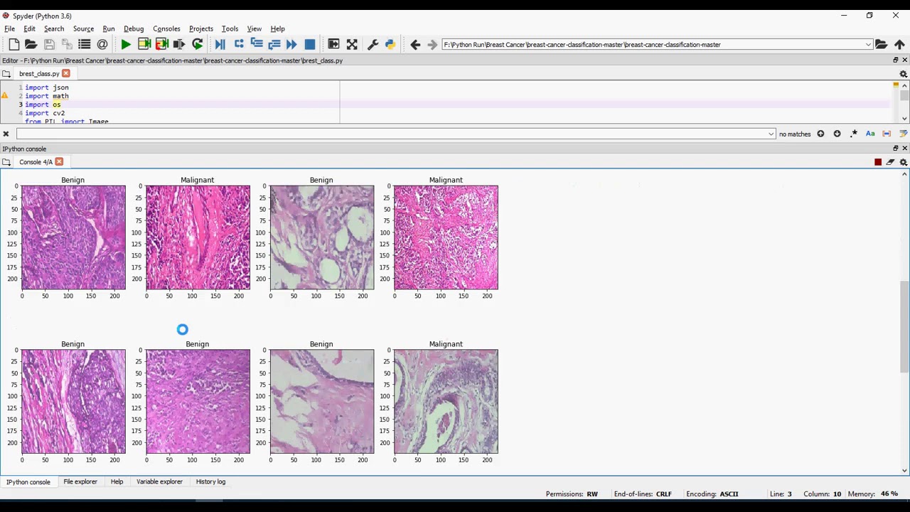 Breast Cancer Classification Using Python Youtube
