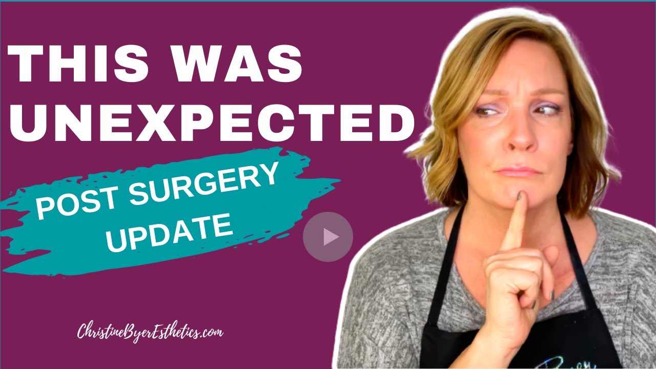 Post Surgery Update 3 Months Youtube
