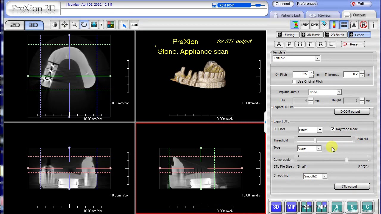 Prexion Training Tips Exporting An Stl File Youtube