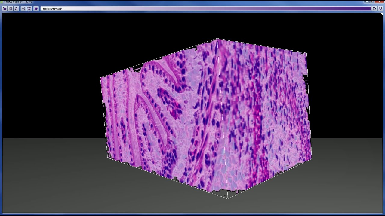 3dhistech Cell Nuclei Detection In 3dview Software Youtube