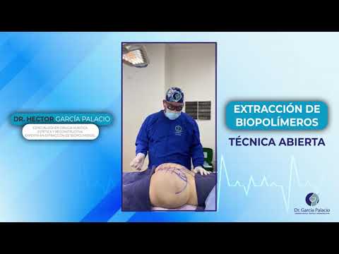 Extracción De Biopolímeros En Zona Glutea Comunícate Al 3164658468