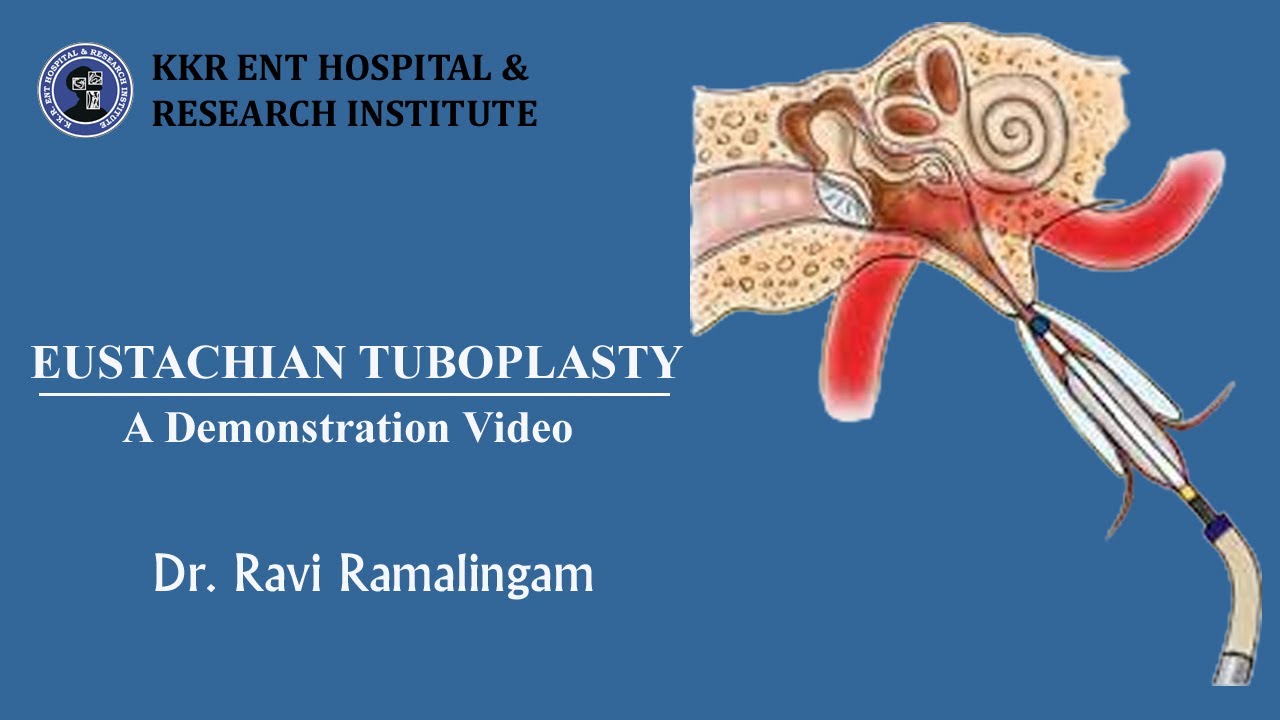 Fluid In Eustachian Tubes Adults