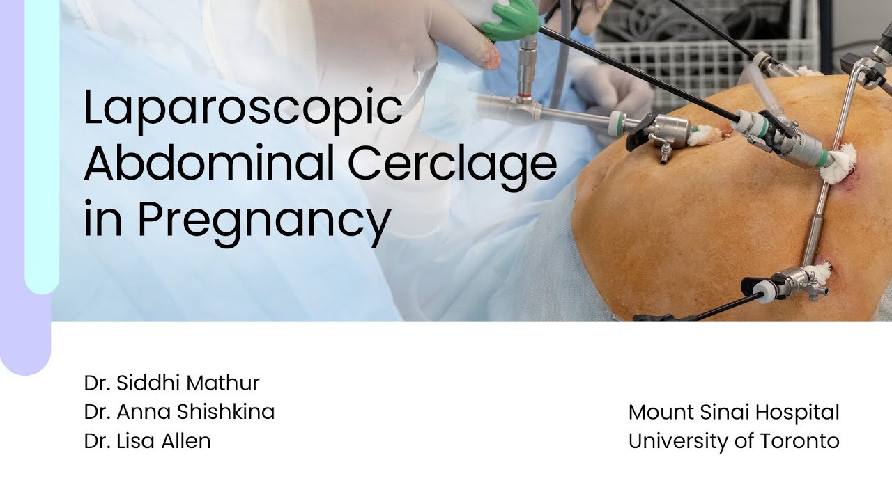 Laparoscopic Abdominal Cerclage In Pregnancy Youtube