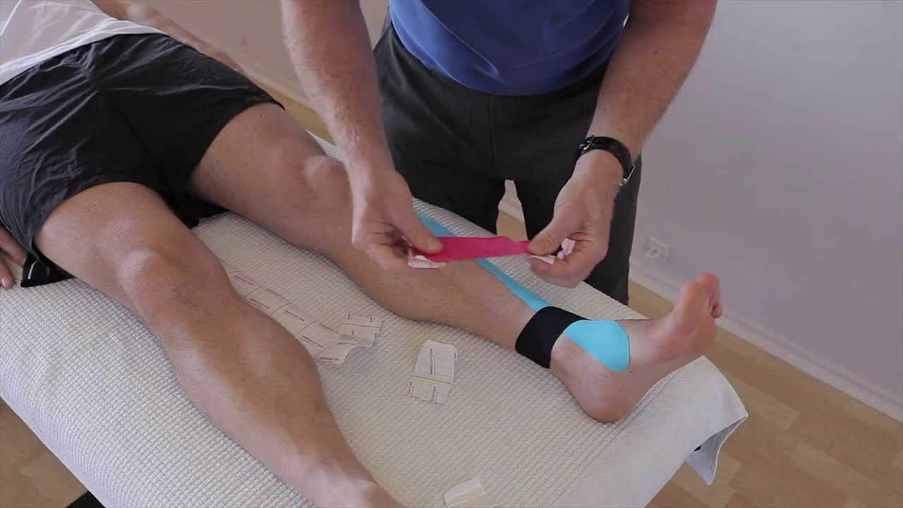 How To Treat Anterior Shin Splints With Kinesiology Taping Youtube