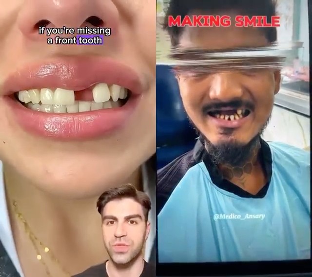 Missing Tooth Discover Instant Confidence Magic Trending Youtube