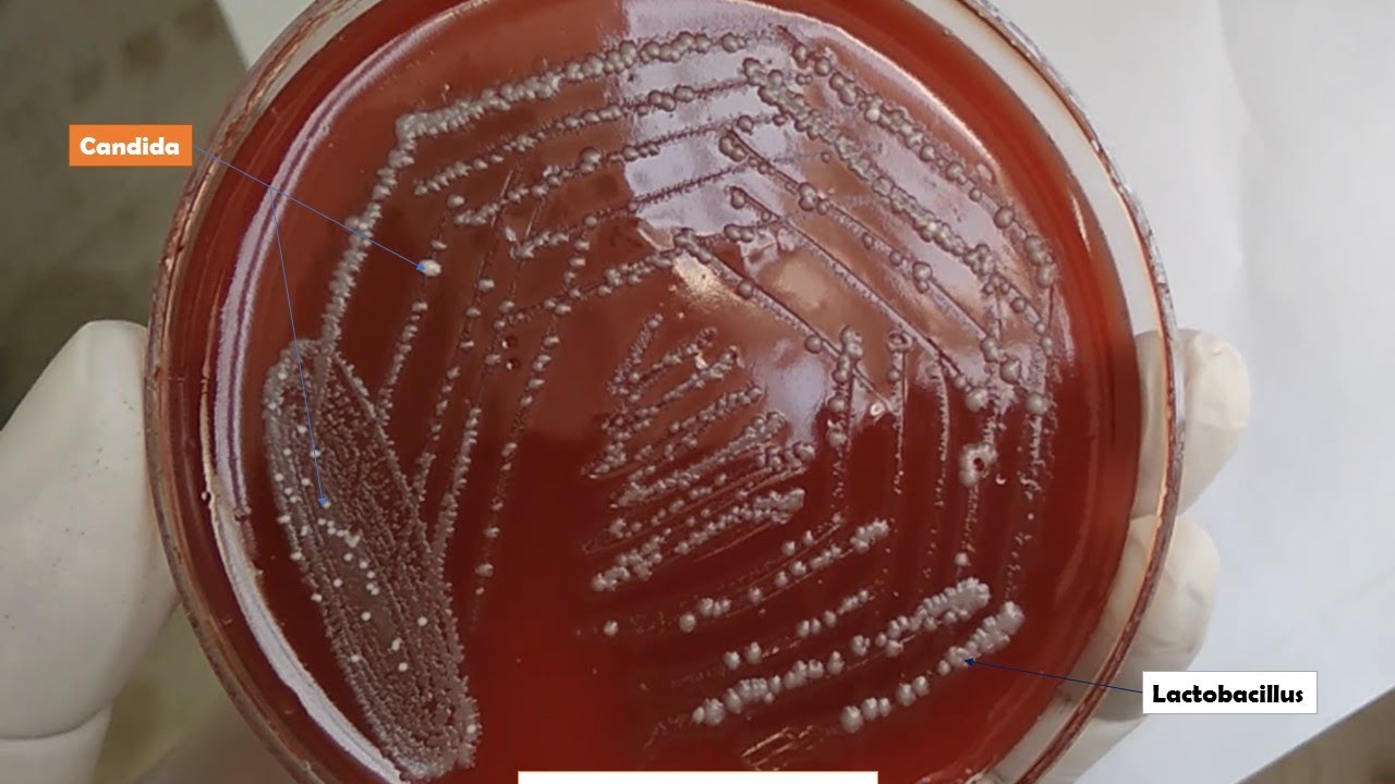 Candida And Lactobacillus Colony Morphology On Blood Agar Youtube
