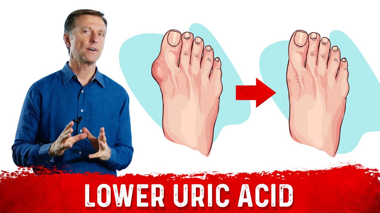 4 Ways To Neutralize Uric Acid Youtube