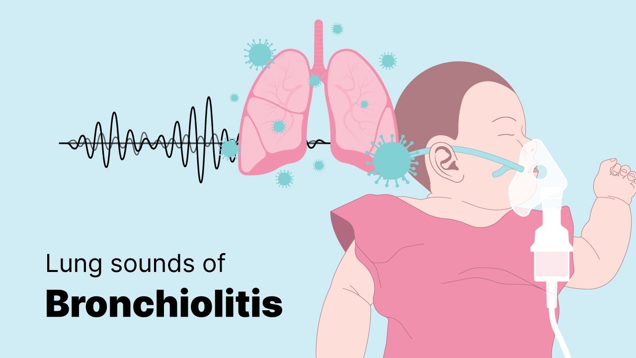 Sounds Of Bronchiolitis Lung Sounds Youtube
