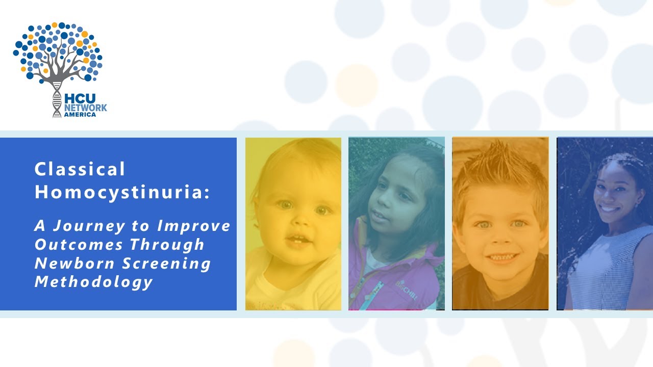 Classical Homocystinuria A Journey To Improve Outcomes Through Newborn
