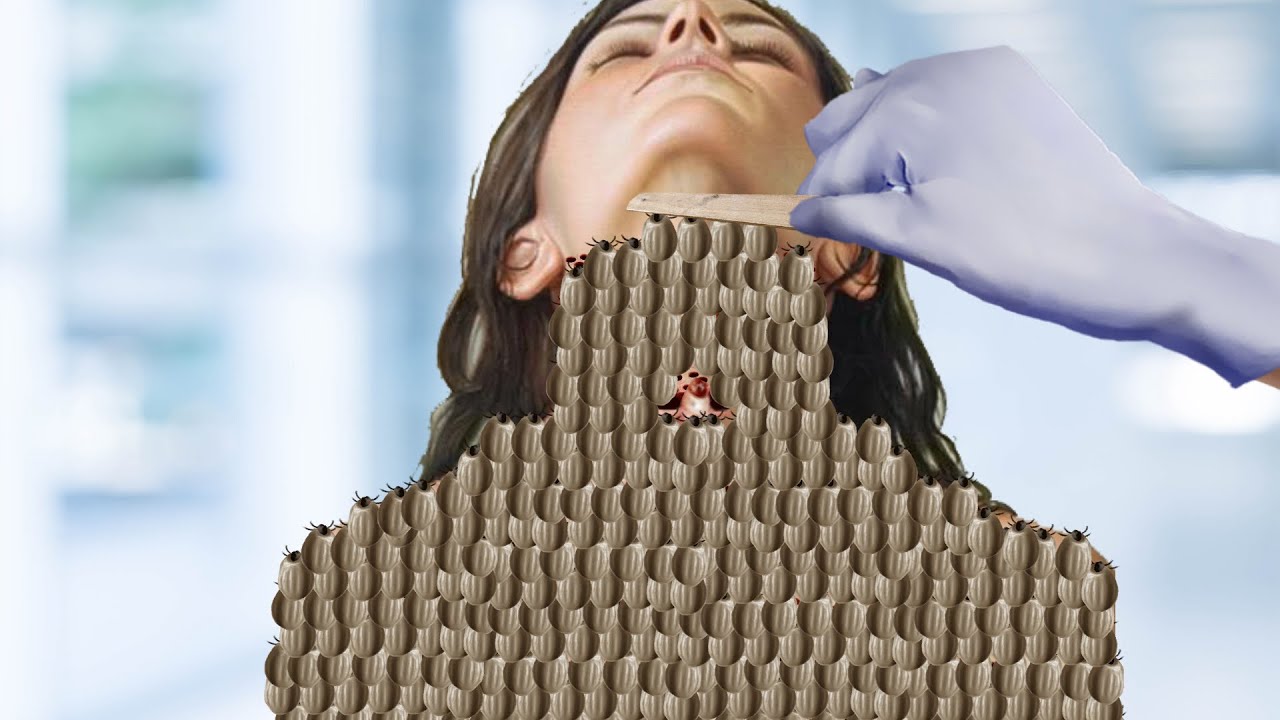Asmr Treatment 2d Animation Asmr Animation Treatment Healasmr914k