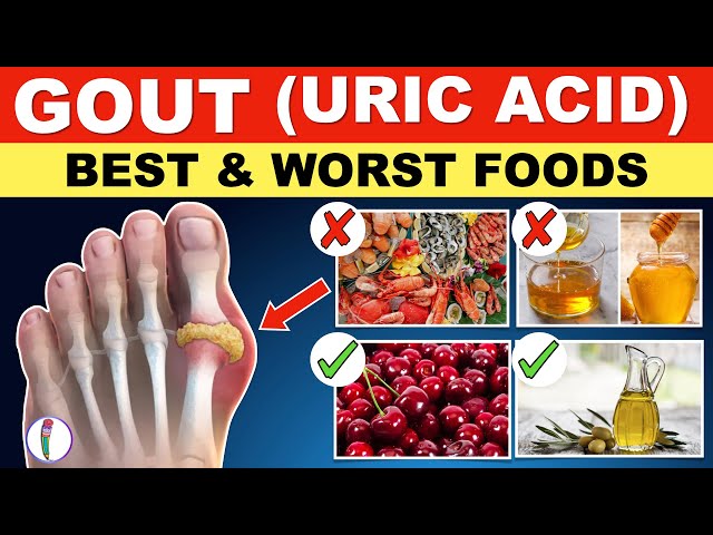 Low Purine Diet For Gout What To Eat Sample Menu And 47 Off