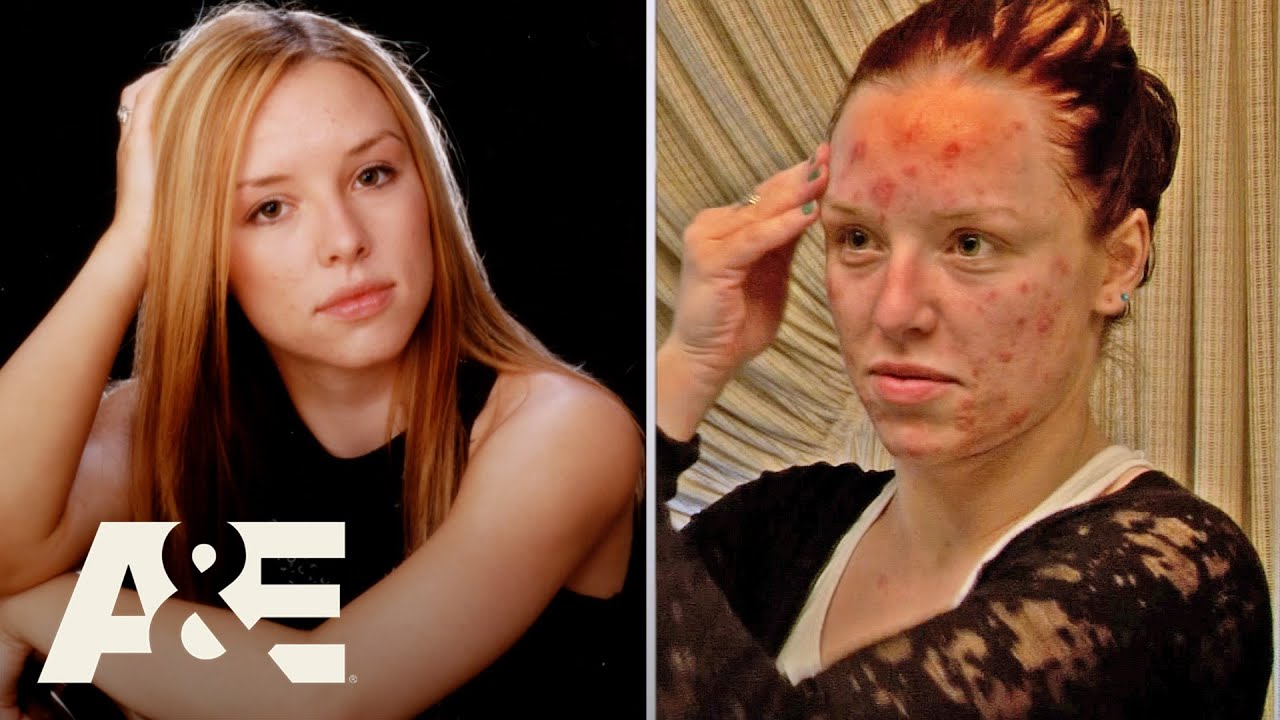 Intervention 9 Years Of Meth Addiction Makes Tiffany Violent And