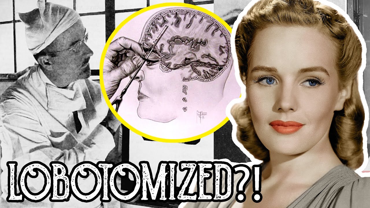 Why Frances Farmers Lobotomy Is One Of The Saddest Stories To Come Out