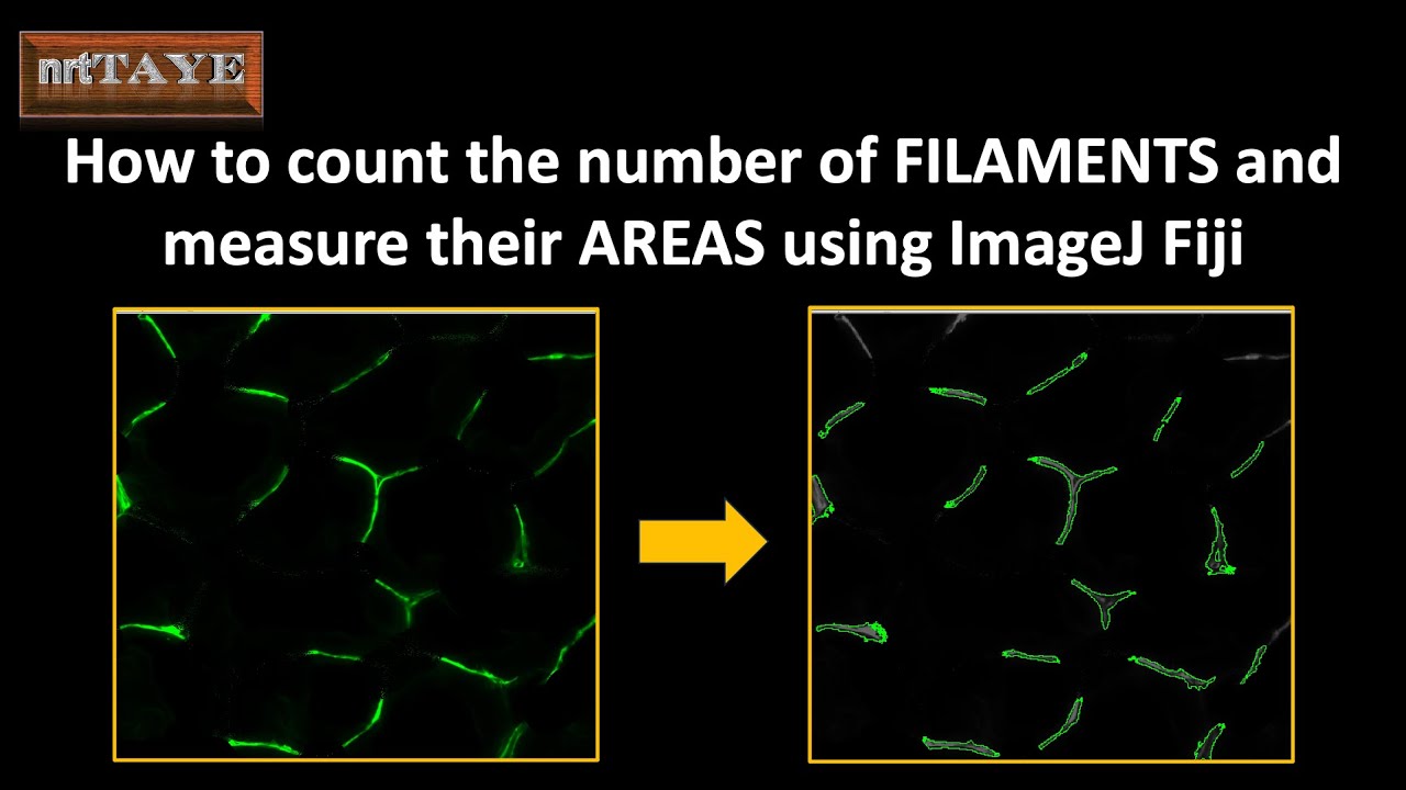 How To Count The Number Of Filaments And Measure Their Areas Using