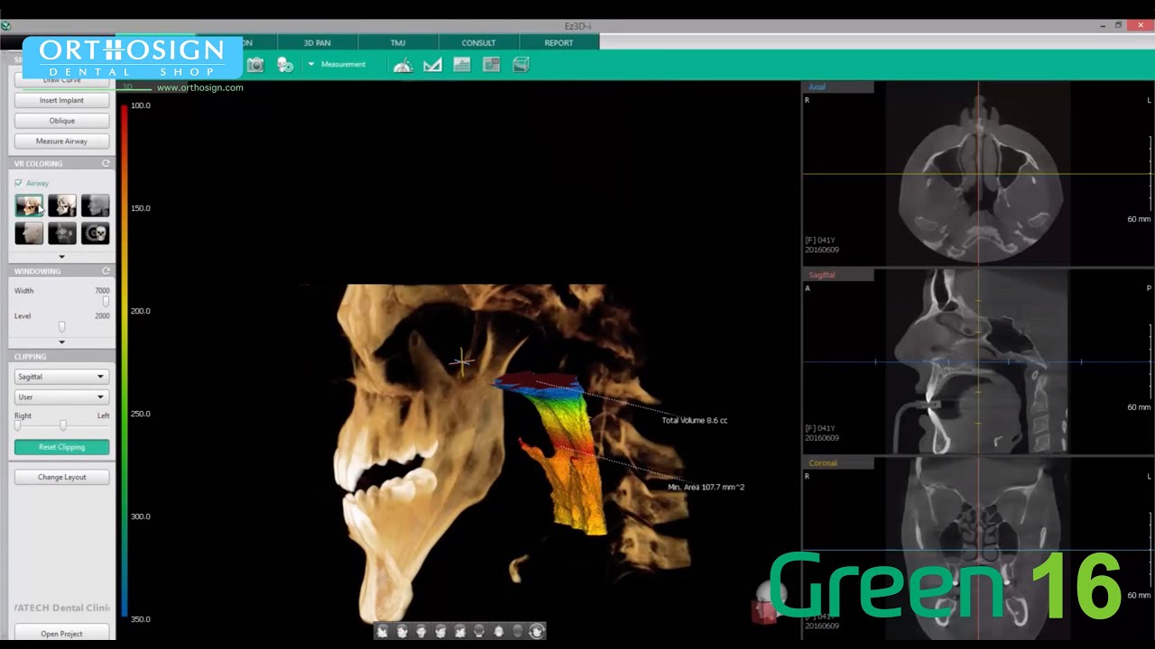 Tomografía Dental Fov 16x9 Vatech Green 16 3d Cone Beam Pano Ceph