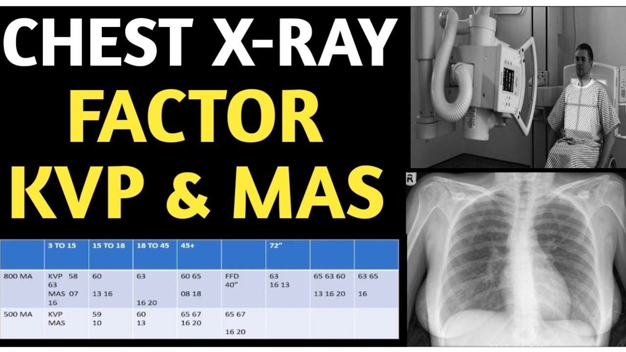Chest X Ray Kvp And Mas At Frank Hudson Blog