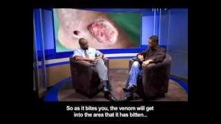 Snakes Interview Dr Moeng 29 October 2012 5050 Community Mp3 Music ...