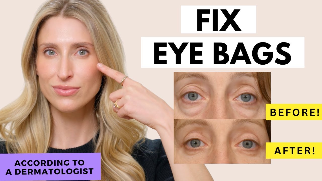 This Is What Will Get Rid Your Your Eye Bags Dr Sam Ellis Youtube