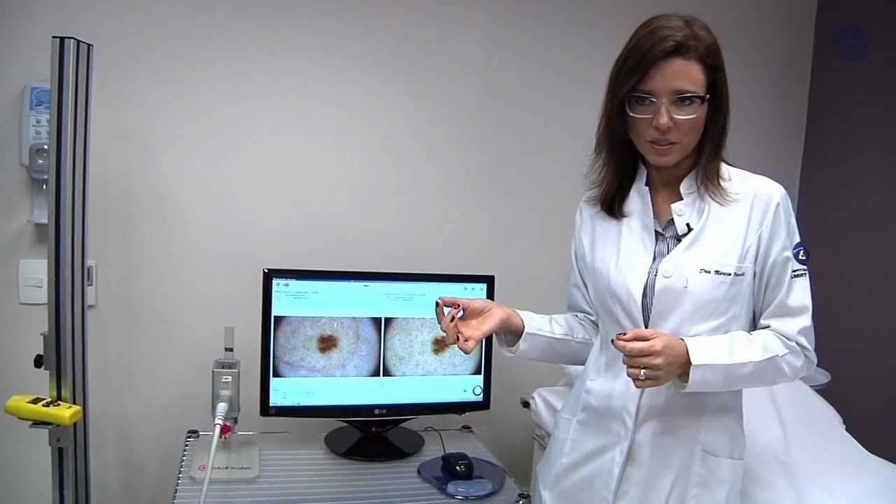 Dermatoscopia Digital Youtube