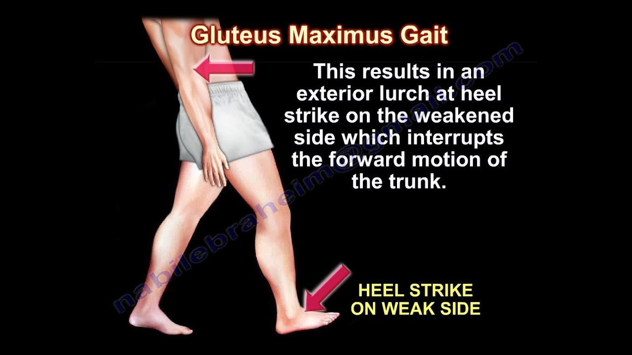 Gluteus Maximus Gait Everything You Need To Know Dr Nabil Ebraheim
