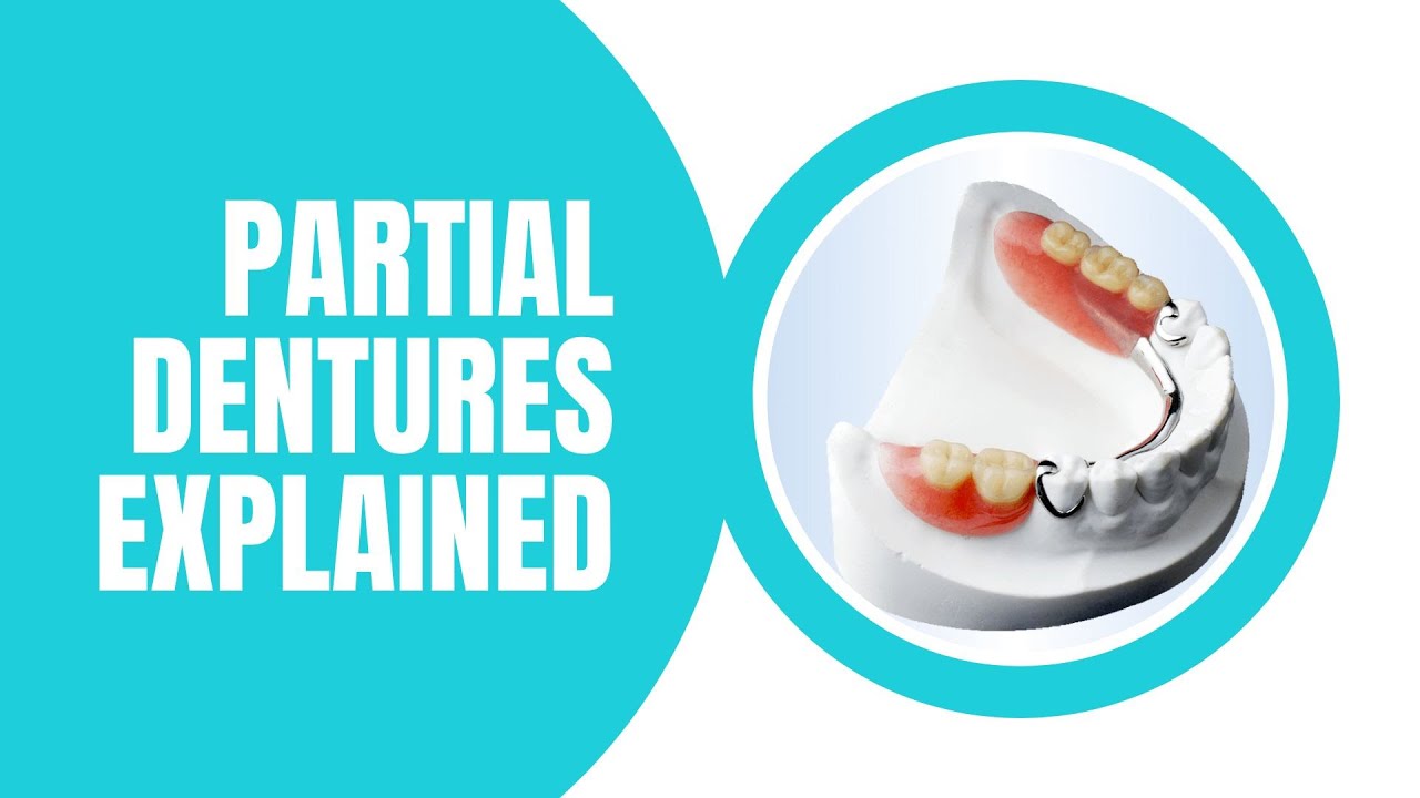 Watch This Before You Get A Partial Denture What You Need To Know
