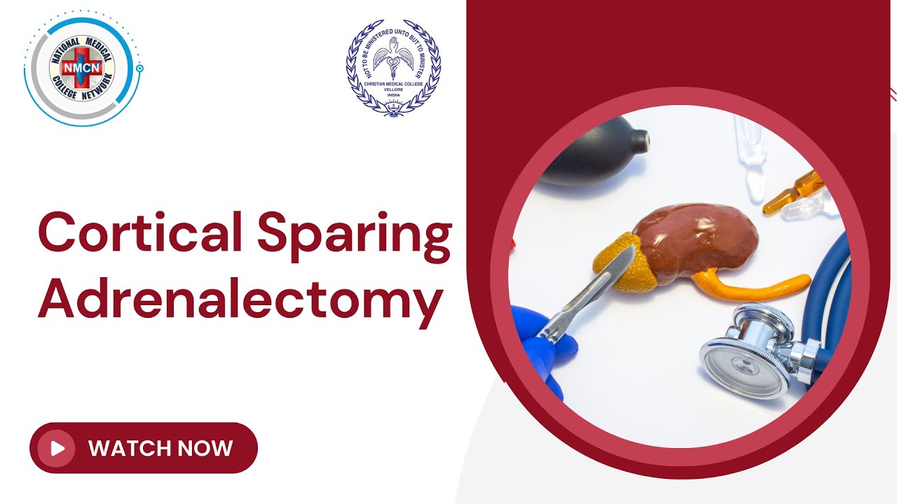 Cortical Sparing Adrenalectomy Youtube