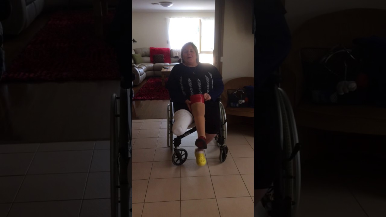 Amputee Dance 2016 Youtube