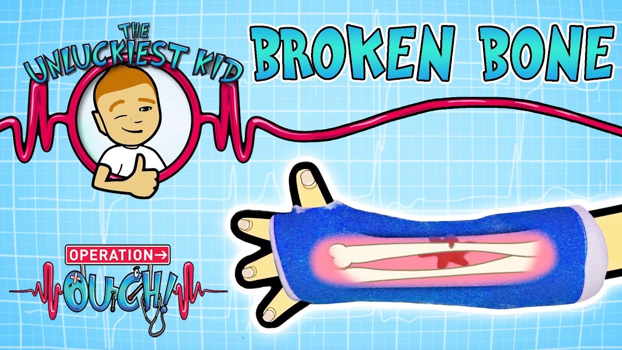 Science For Kids Broken Bones Unluckiest Kid Experiments For Kids
