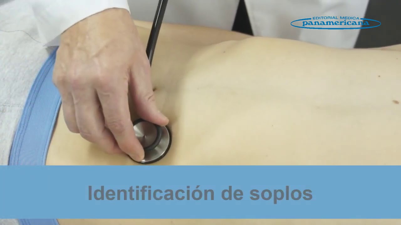 Video 22 Auscultación Del Abdomen Youtube