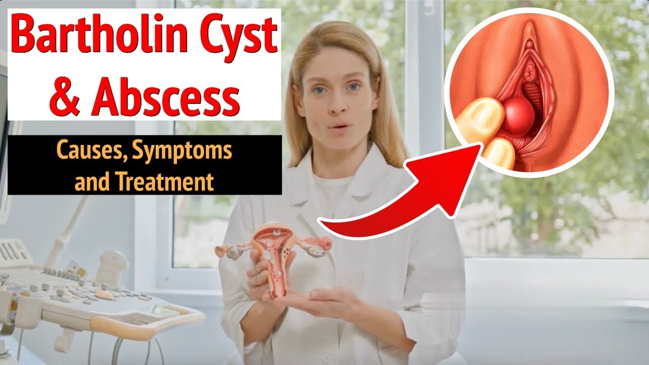 Bartholin Cyst Drain Bartholin Cyst Home Remedies Vs Medical