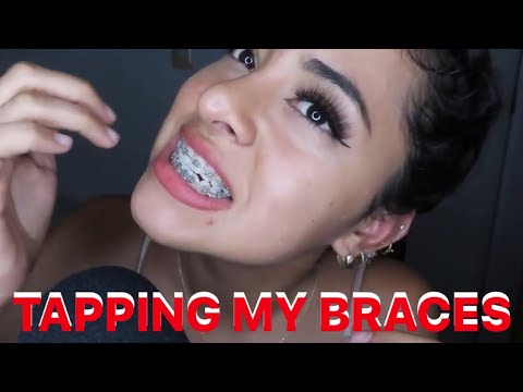 Asmr Tapping My Braces Youtube