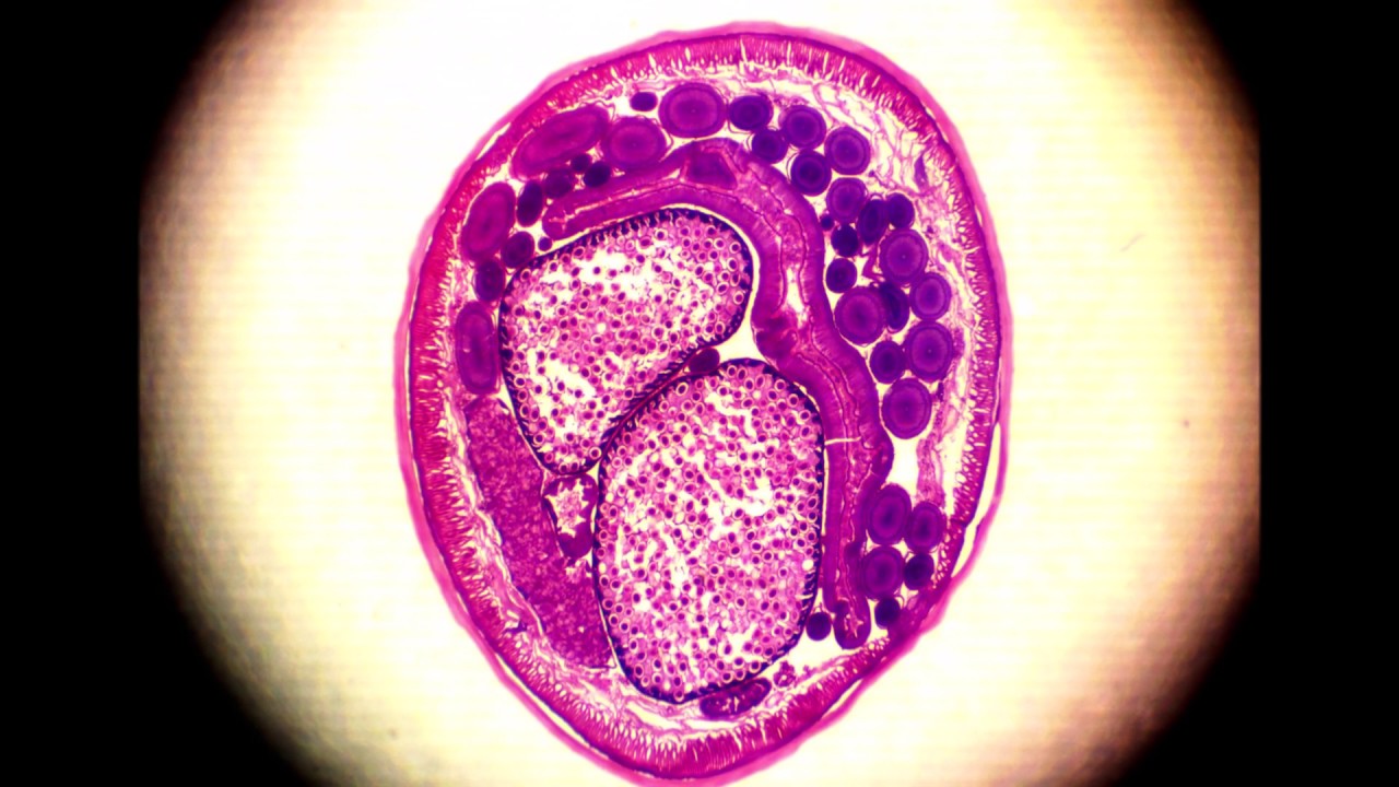 Ova De Ascaris Lumbricoides Egg