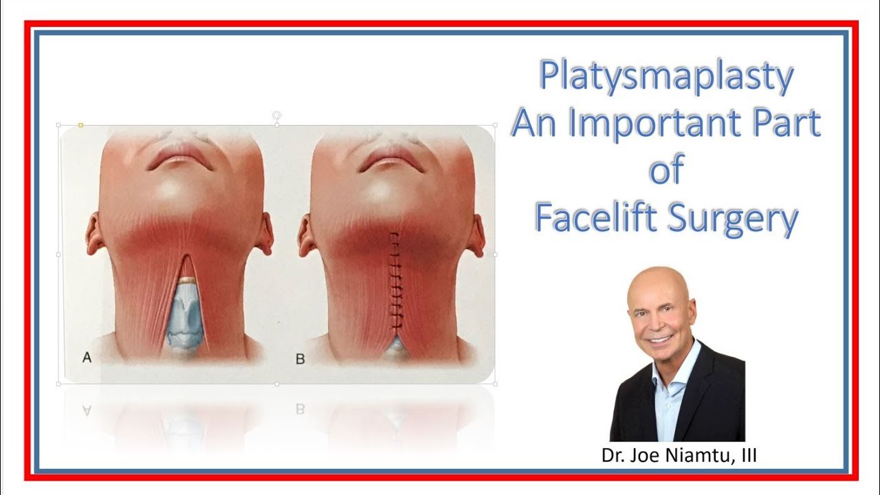 Platysmaplasty A Most Important Part Of A Facelift Youtube