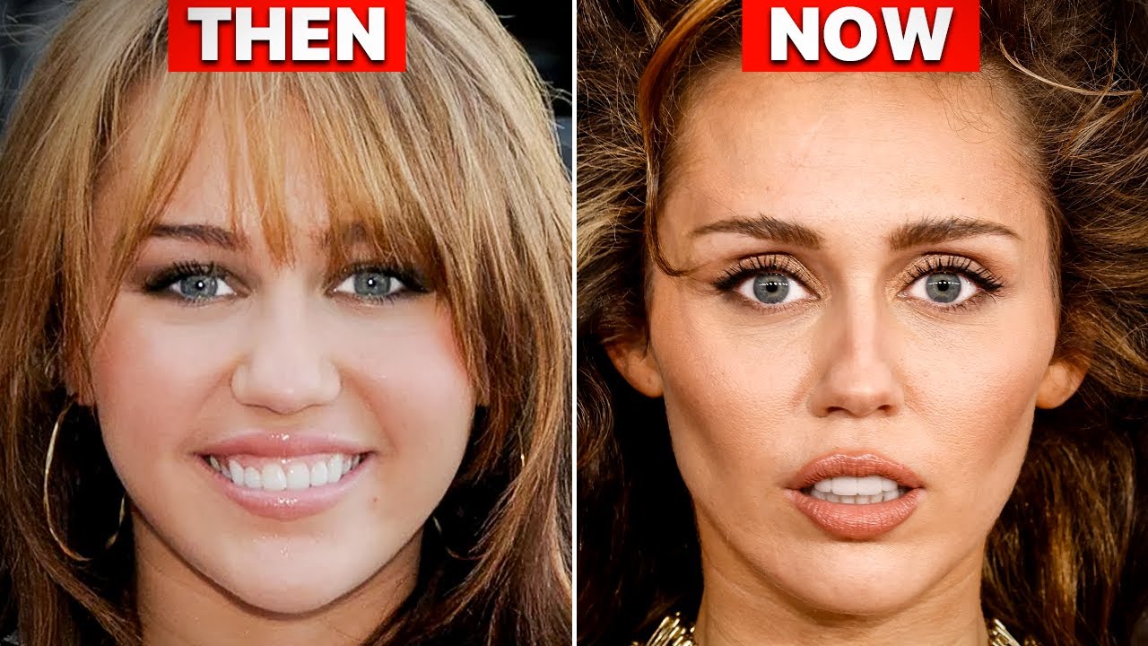 Miley Cyrus Plastic Surgery Before And After Photos