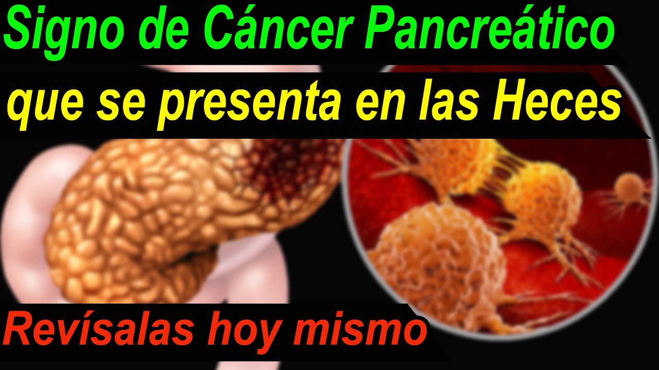 Hoy Mismo Revisa Tus Heces Eso Puede Ser Un Signo Más Urgente De